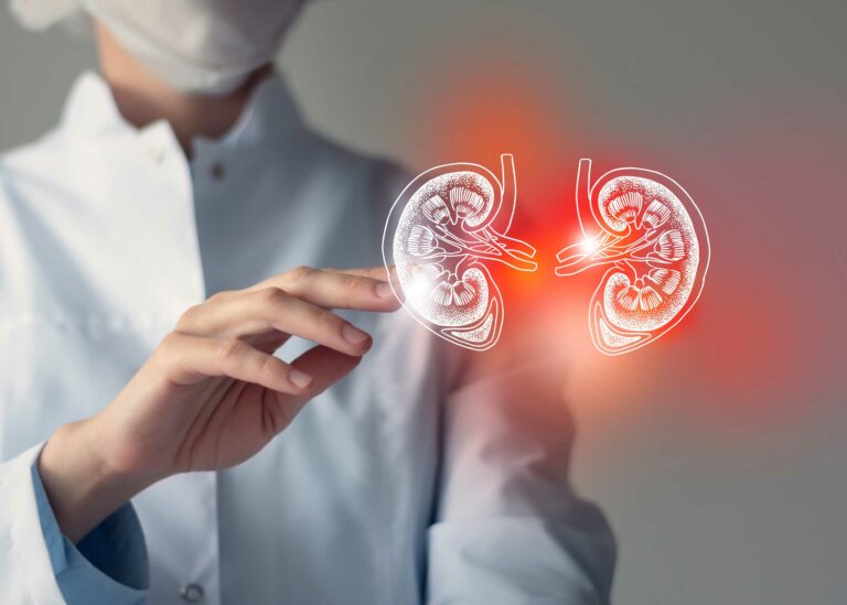Preventing and Treating Kidney Infection Effectively | Abu Dhabi