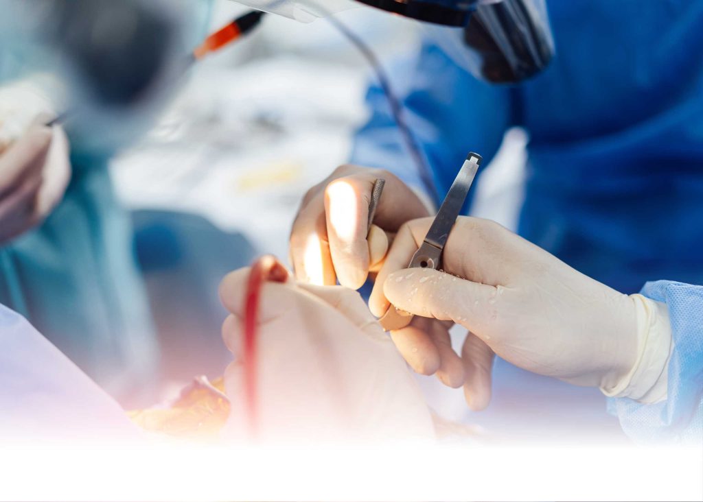 Laparoscopy for Endometriosis | Guide by Gynecologists | Medeor